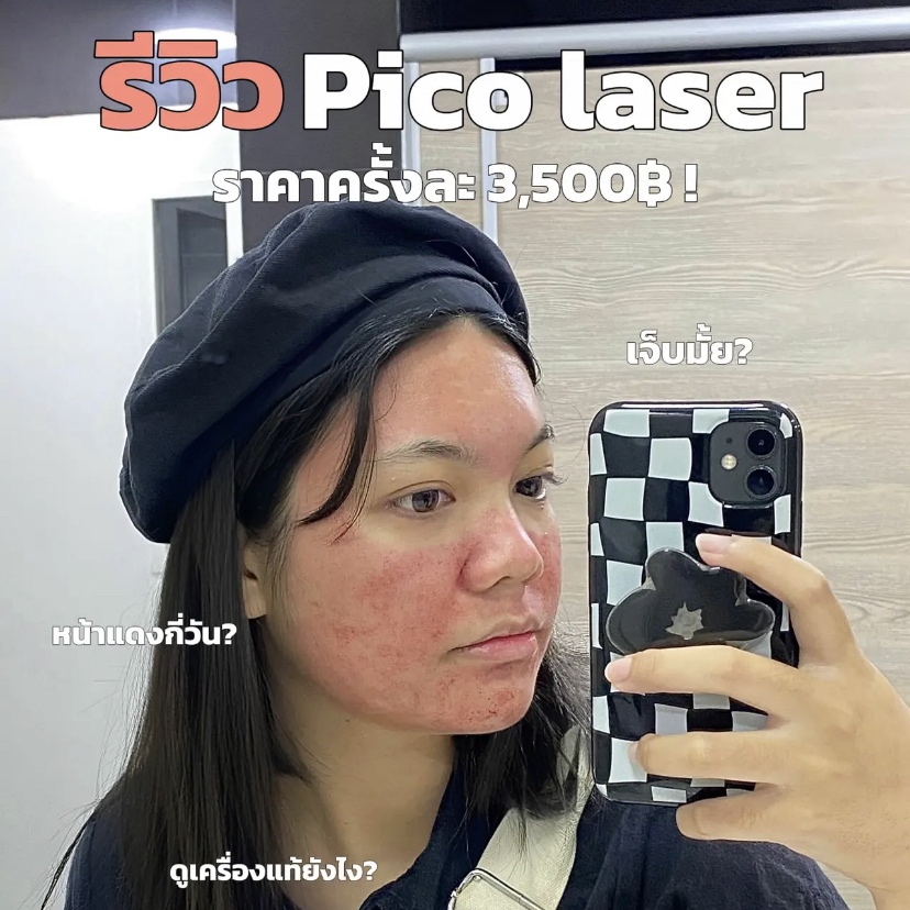 รีวิว pico laser ทำครั้งแรกเหมือนได้ผิวใหม่จริงมั้ย?